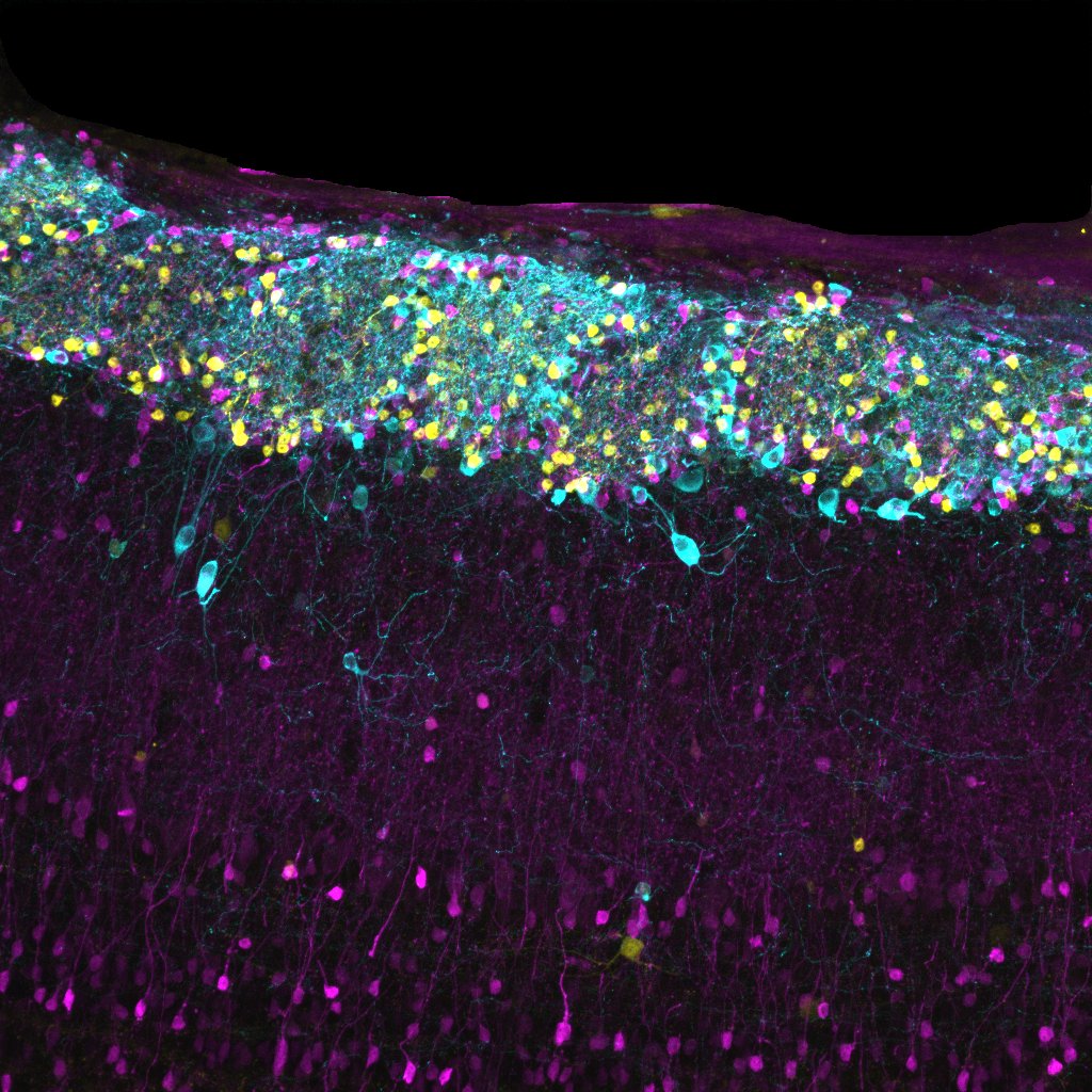 PG Cell Types | Computations in neural circuits